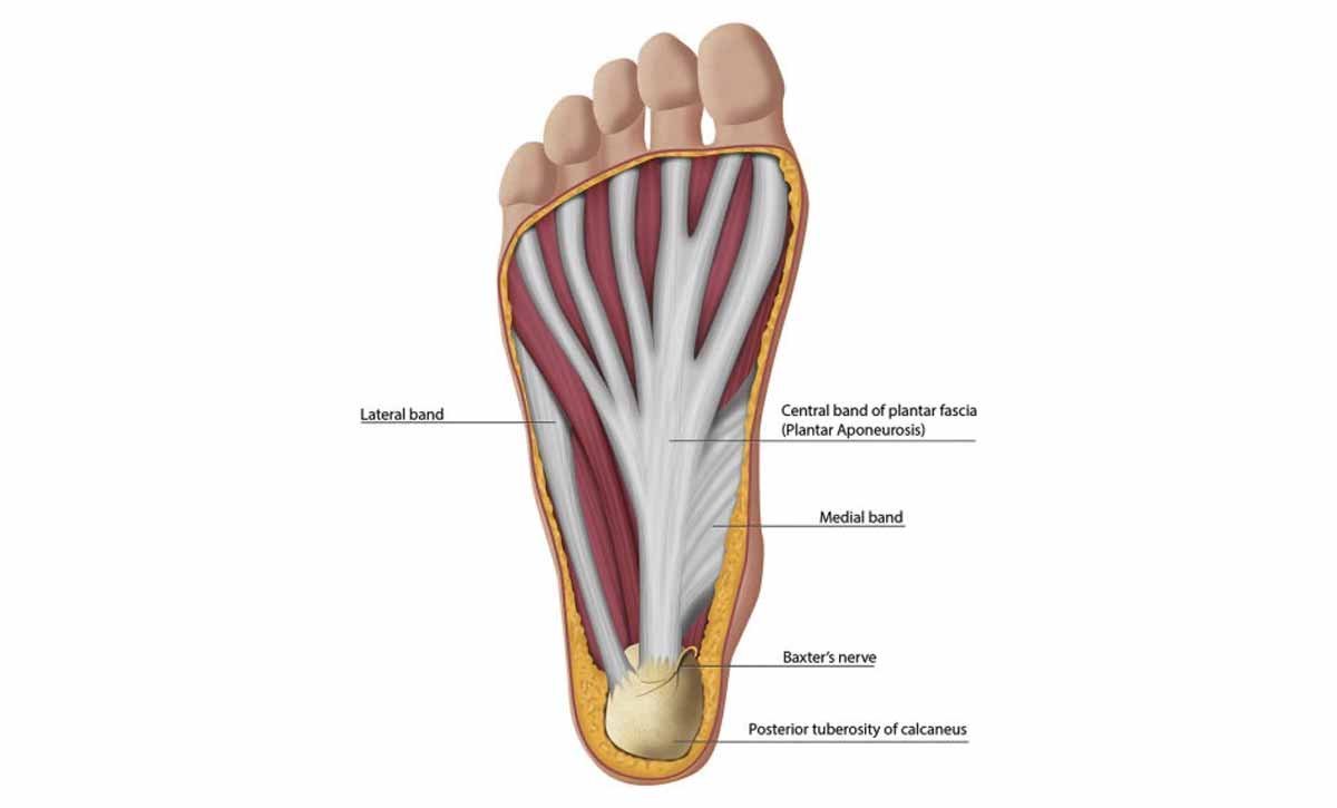 How to Fully Recover from Plantar Fasciitis | Engage PT